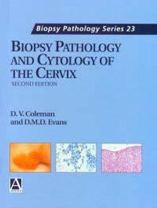 Biopsy Pathology And Cytology of the Cervix, D.V. Coleman ...