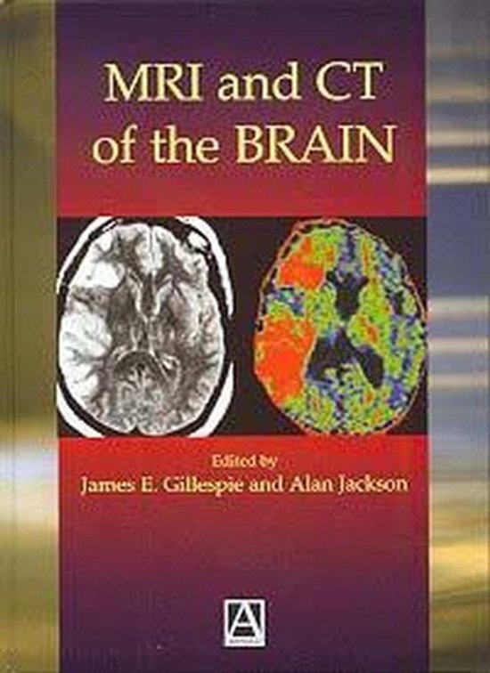 Mri and Ct of the Brain, Alan Jackson | 9780340761212 | Boeken | bol
