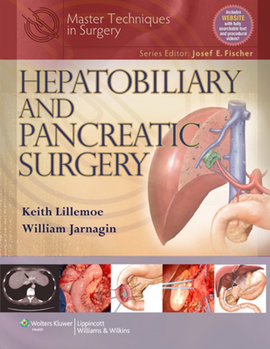 Master Techniques In Surgery 9781608311729 Keith Lillemoe Boeken