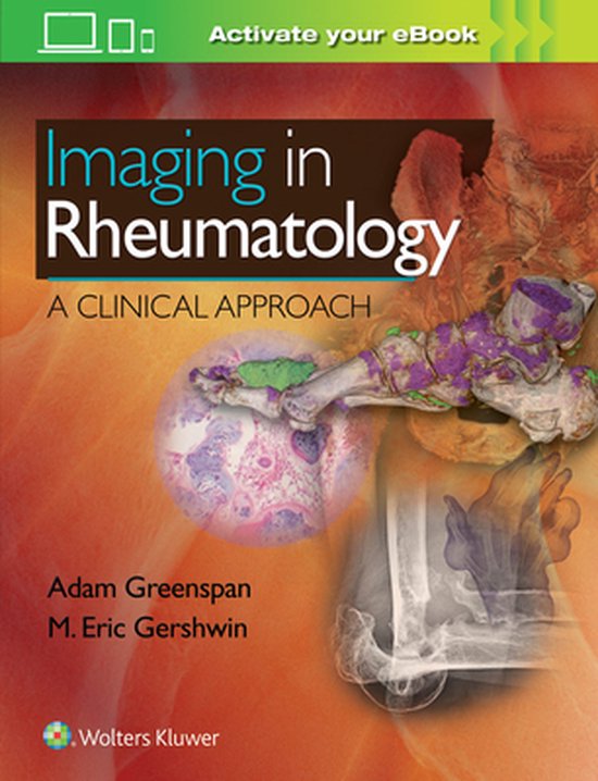Imaging in Rheumatology | 9781496367631 | Adam Greenspan | Boeken | bol.com