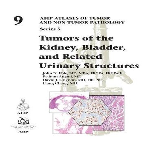 AFIP Atlases of Tumor and Non-tumor Pathology, Series 5- Tumors of the Kidney,... | bol.com