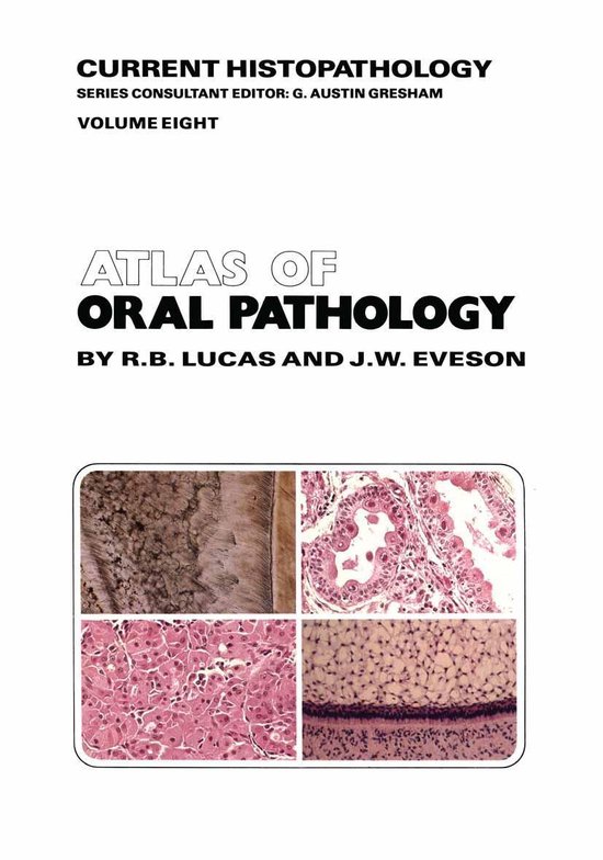 Current Histopathology 8 - Atlas of Oral Pathology (ebook), R. B. Lucas ...