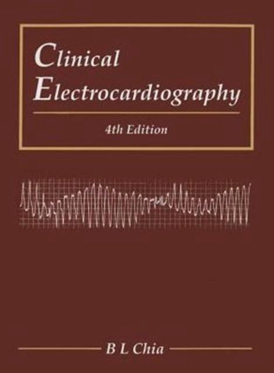 Clinical Electrocardiography | 9789814723268 | Boon Lock Chia | Boeken ...
