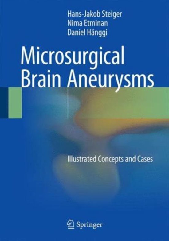 Microsurgical Brain Aneurysms | 9783662456781 | Nima Etminan | Boeken ...
