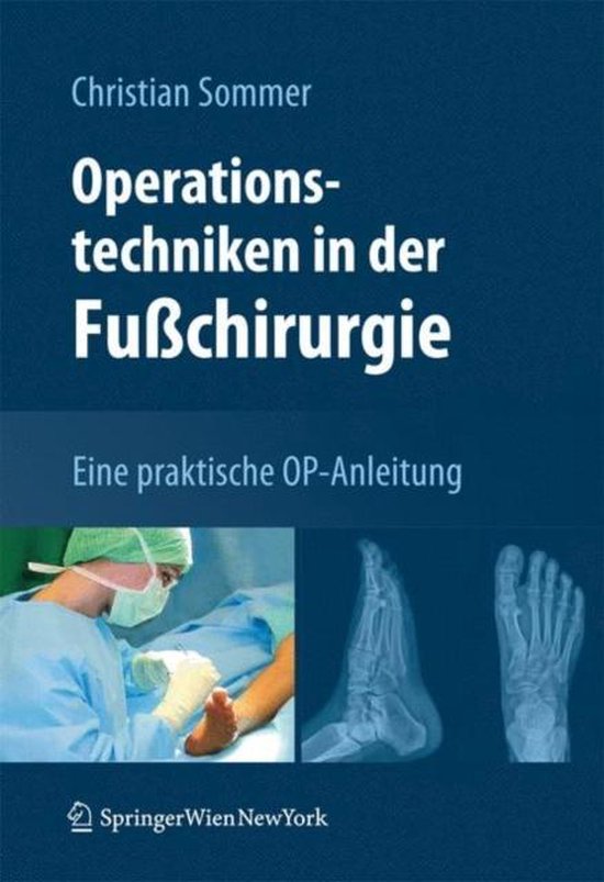 Operationstechniken in Der Fu chirurgie: Eine Praktische Op-Anleitung | 9783211994221... | bol.com