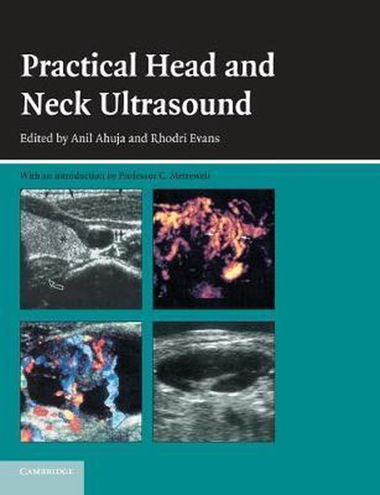 Practical Head and Neck Ultrasound | 9780521683210 | Anil T. Ahuja ...