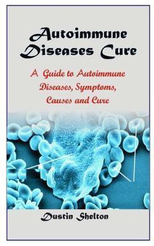 Autoimmune Diseases Cure, Dustin Shelton | 9798687597357 | Boeken | bol.com