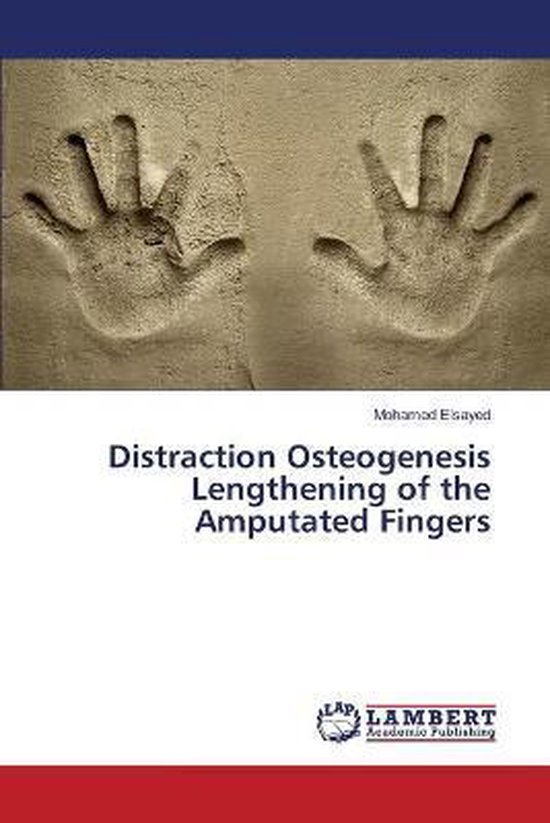 Distraction Osteogenesis Lengthening of the Amputated Fingers ...