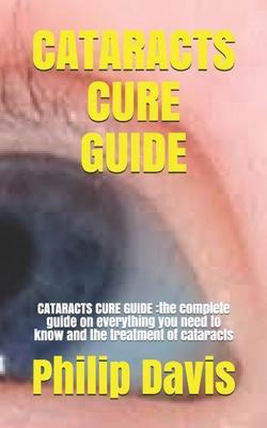Cataracts Cure Guide: CATARACTS CURE GUIDE | 9798526146210 | Philip ...
