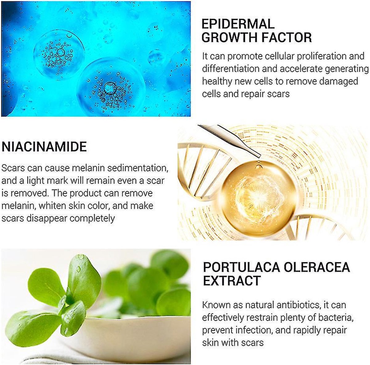 Litteken En Striae Verwijderen Huidcrème Acne Litteken Behandeling Voor ...