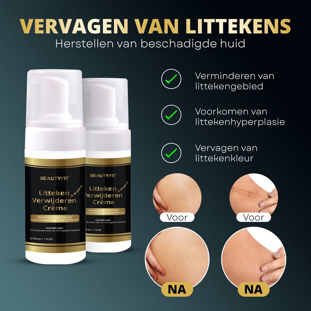 BeautyFit - Littekencreme - Litteken verwijderaar - makkelijk Littekens ...