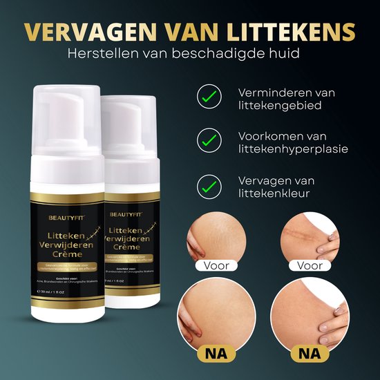 BeautyFit - Littekencreme - Litteken verwijderaar - makkelijk Littekens ...