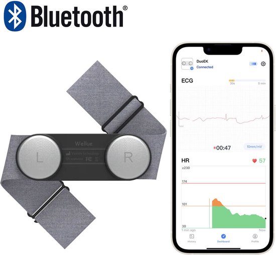 ViAtom DuoEK Persoonlijke ECG-monitor, Draagbare ECG-monitor met ...