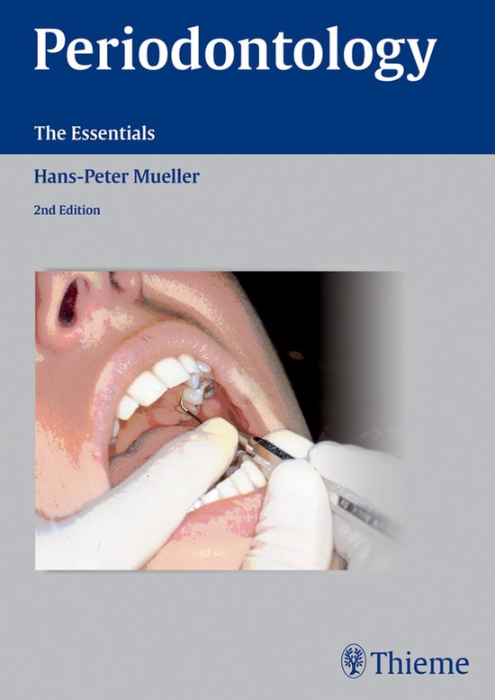 Periodontology (ebook), Hans-Peter Müller | 9783132579736 | Boeken ...