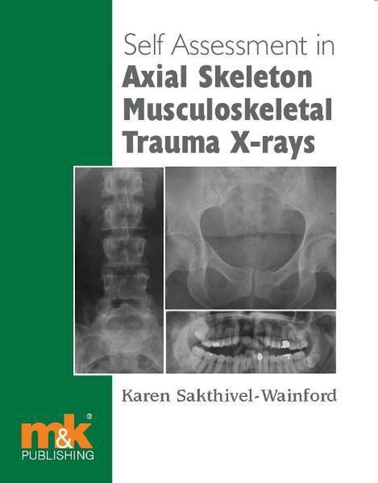 1 - Self-assessment in Axial Musculoskeletal Trauma X-rays (ebook ...