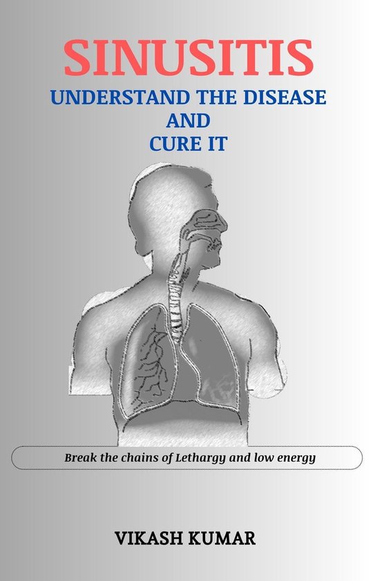 Sinusitis : Understand the disease and cure it (ebook), Vikash Kumar ...
