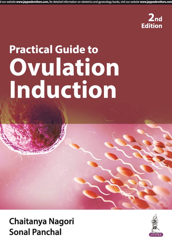 Practical Guide to Ovulation Induction, Sonal Panchal | 9789356964853 | Boeken | bol