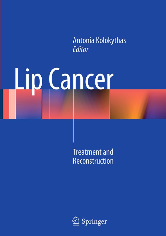 Lip Cancer | 9783662509326 | Boeken | bol