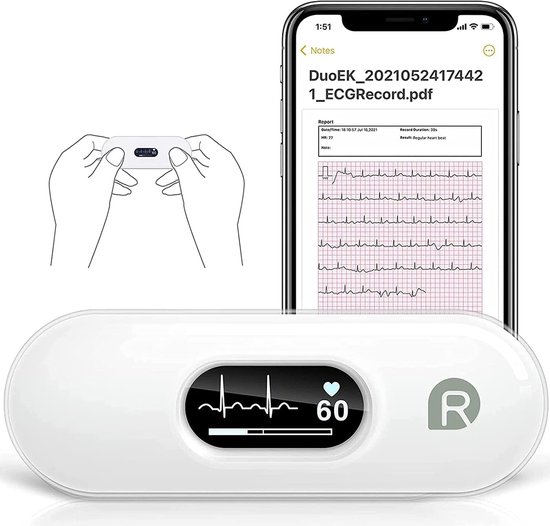 UltraMed DuoEK-S Smart Professionele ECG-monitor voor Elektrocardiogram ...