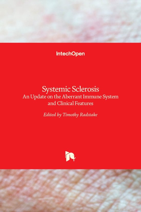 Systemic Sclerosis | 9789533078694 | Boeken | bol.com
