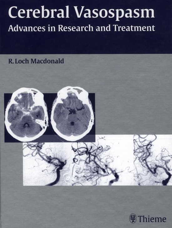 Cerebral Vasospasm (ebook), R. Loch Macdonald | 9781638532316 | Boeken ...