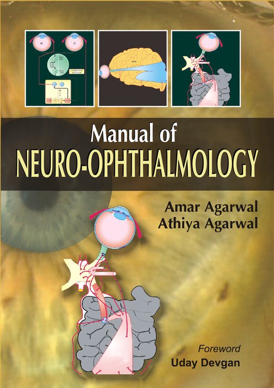 Manual of Neuro-ophthalmology | 9780071632317 | Amar Agarwal | Boeken | bol