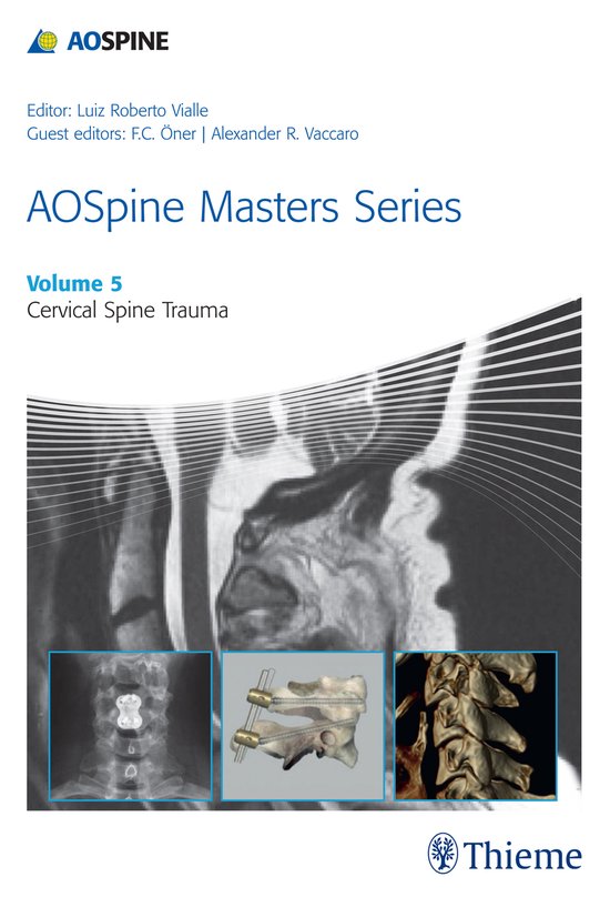 AOSpine Master Series 05: Cervical Spine Trauma | 9781626232235 | Luiz ...