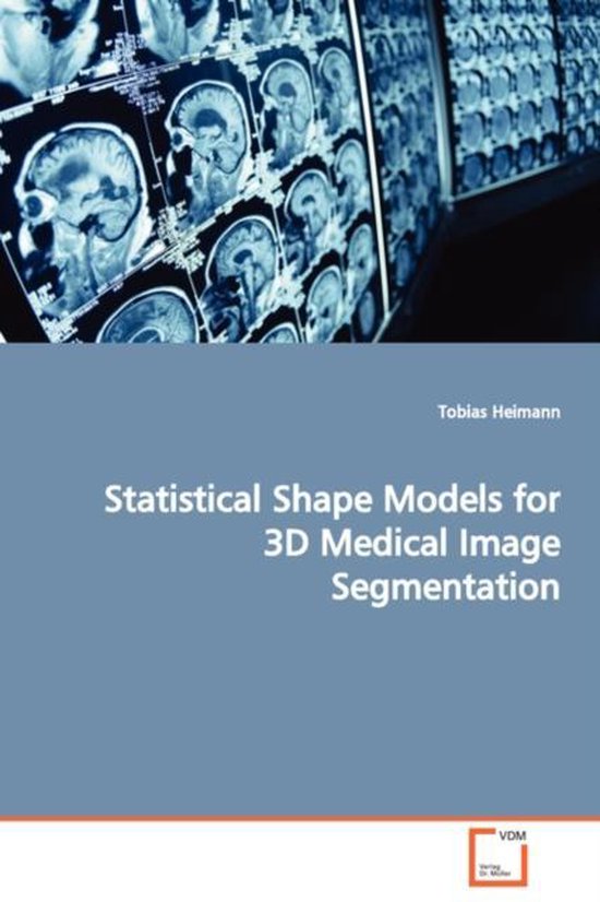 Statistical Shape Models for 3D Medical Image Segmentation | 9783639050561 | Tobias... | bol