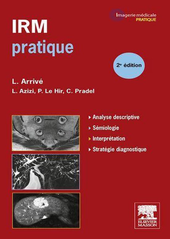 IRM pratique (ebook), Michel Blery | 9782294729492 | Boeken | bol