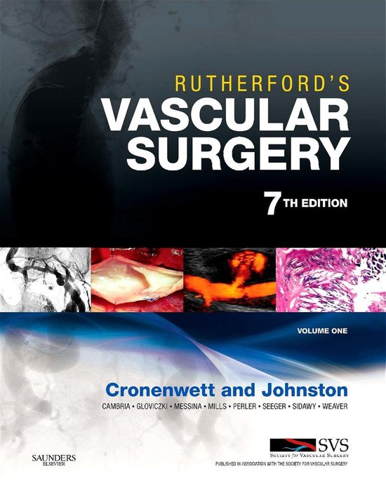 Rutherford's Vascular Surgery, 2-Volume Set | 9781416052234 | Jack ...