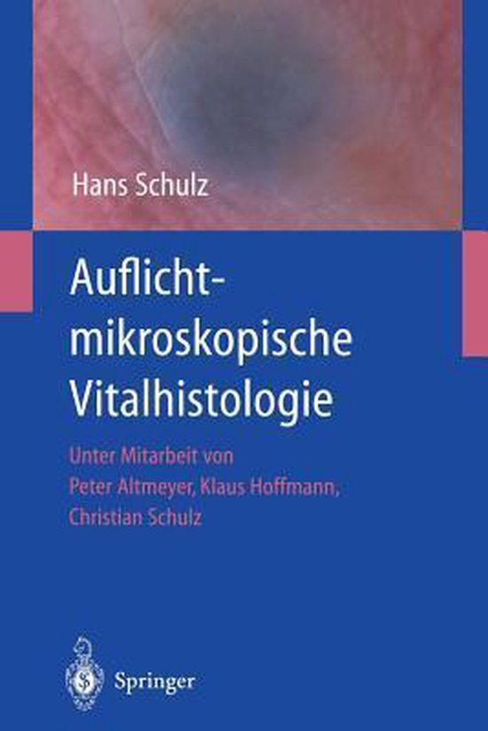 Auflichtmikroskopische Vitalhistologie | 9783642626692 | Hans Schulz ...