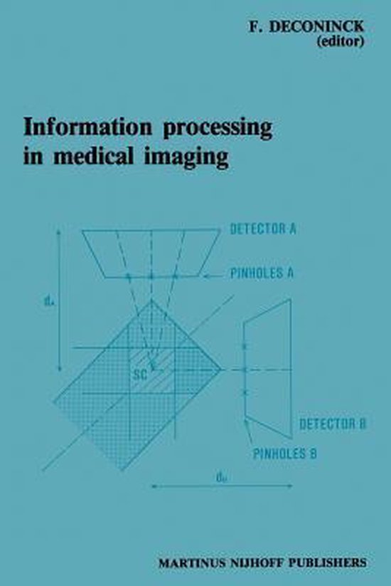 Information Processing in Medical Imaging | 9789400960473 | Boeken | bol.com