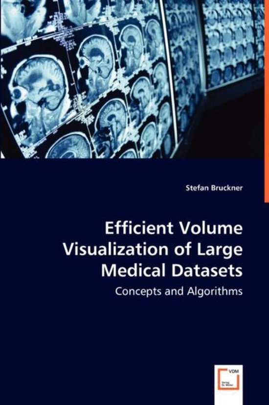 Efficient Volume Visualization of Large Medical Datasets - Concepts and ... Efficient Volume Visualization of Large Medical Datasets - Concepts and ...