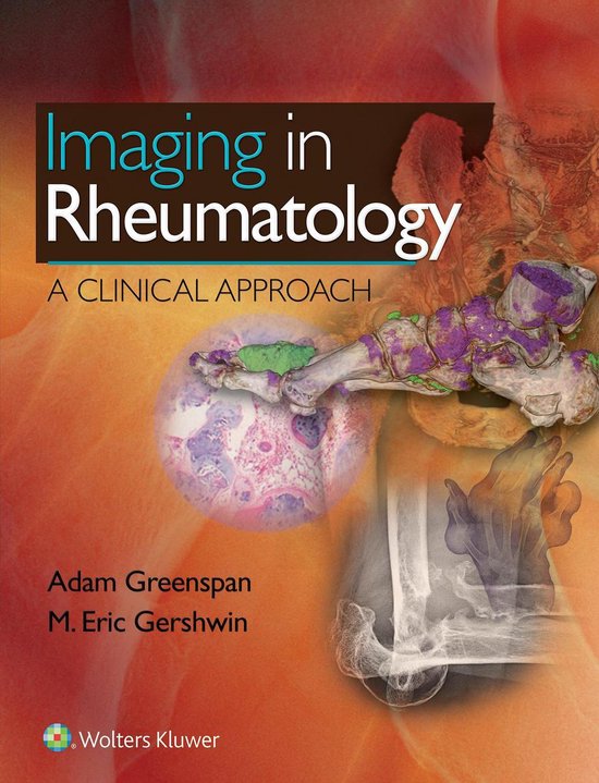 Imaging in Rheumatology (ebook), Adam Greenspan | 9781496367655 ...