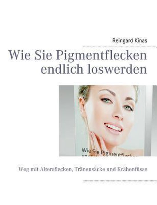 Wie Sie Pigmentflecken Endlich Loswerden, Reingard Kinas | 9783000437397 | Boeken | bol.com