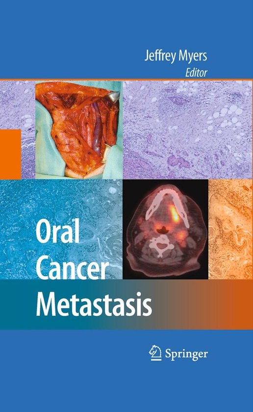 Oral Cancer Metastasis (ebook) | 9781441907752 | Boeken | bol.com