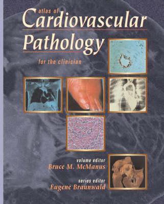 Atlas of Cardiovascular Pathology for the Clinician | 9781573401609 ...