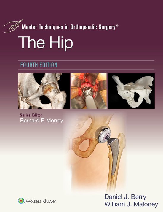Master Techniques in Orthopaedic Surgery: The Hip (ebook), Daniel J ...