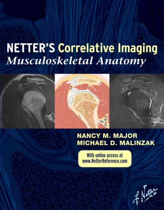Netter's Correlative Imaging: Musculoskeletal Anatomy | 9781437700121 ...
