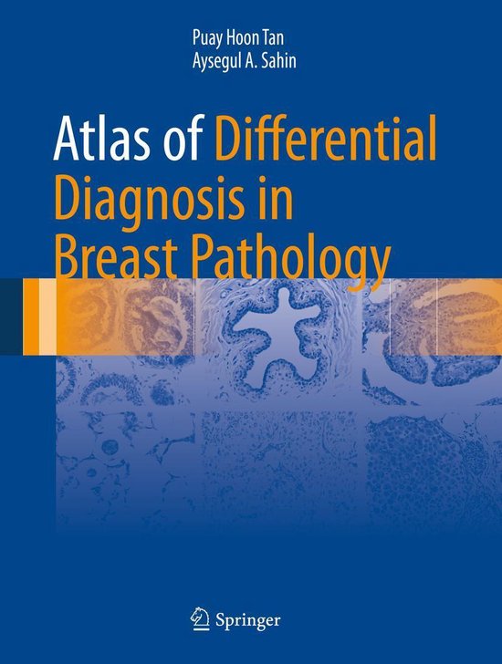 Atlas of Anatomic Pathology - Atlas of Differential Diagnosis in Breast ...