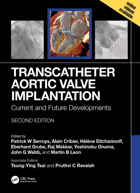 Transcatheter Aortic Valve Implantation | 9781032471471 | Boeken | bol
