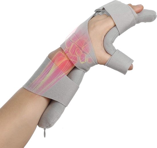 Hand Spalk Functionele Vinger Orthose Zachte Functie Rustende Hand ...
