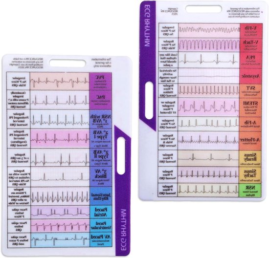 Elektrocardiogram Ritme Interpretatie Kaarten - Set van 2 ...
