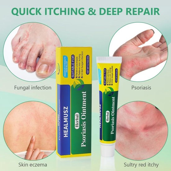 Je kunt de titel als volgt aanpassen:- Zalf en Crème voor Psoriasis ...