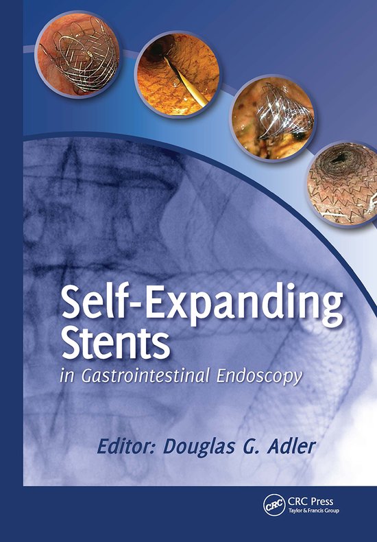 Self-Expanding Stents in Gastrointestinal Endoscopy | 9781617110283 ...