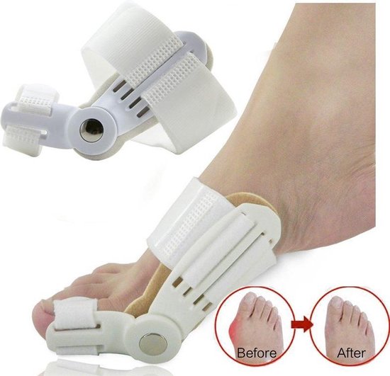 2x Orthèse d'orteil - Attelle gros orteil - Attelle Hallux Valgus Night ...
