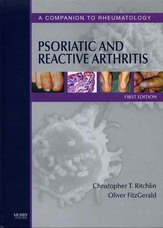 Psoriatic and Reactive Arthritis E-Book (ebook), Oliver FitzGerald ...