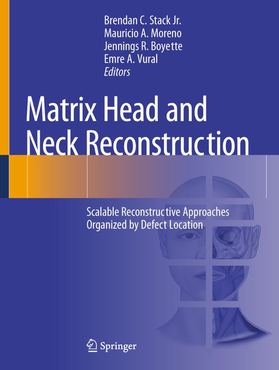 Matrix Head and Neck Reconstruction | 9783031249808 | Boeken | bol.com
