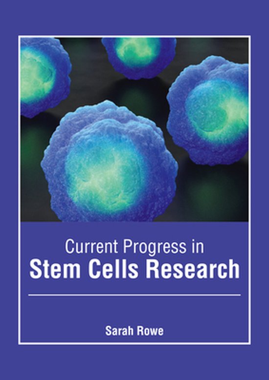 Current Progress in Stem Cells Research | 9781632429025 | Boeken | bol.com