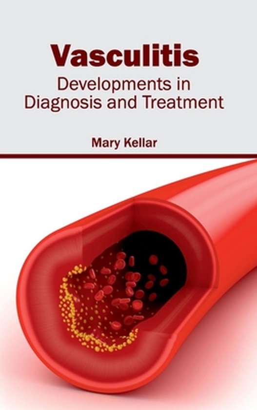 Vasculitis: Developments in Diagnosis and Treatment | 9781632413819 ...